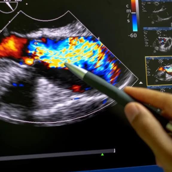 Patient - PRP Diagnostic Imaging