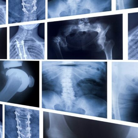 What are the 5 Medical Imaging Techniques?