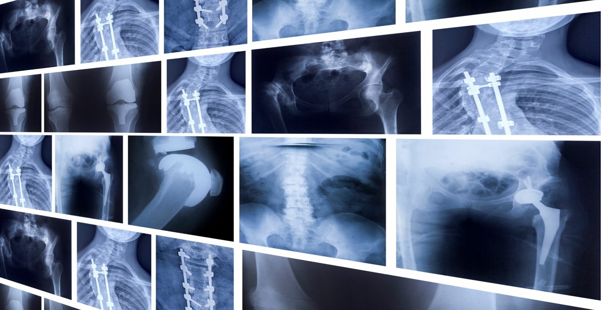 What are the 5 Medical Imaging Techniques?