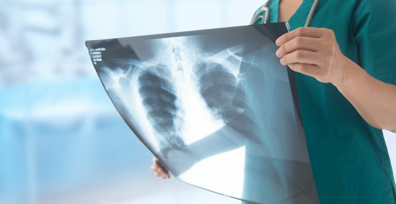What to Expect from Your X-Ray Appointment - PRP Diagnostic Imaging