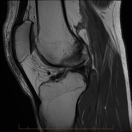 PRP Diagnostic Imaging - All Radiology Referrals Accepted